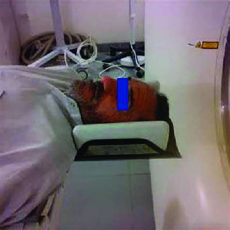 Pdf Ct Scans Imaging Of Human Ethmoid Sinuses And Gross Anatomical