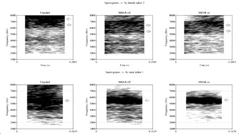 Spectrograms Of S Unaided And Pre And Post Processing By Download Scientific Diagram