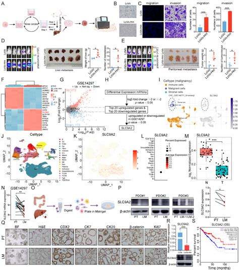 肿瘤抑制因子slc9a2通过抑制stat3 Vegfa信号轴逆转结直肠癌肝转移和免疫治疗耐药 生物通