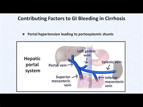 Variceal Bleed Antibiotics