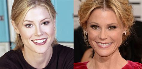 Julie Bowen Looks Even Prettier After Plastic Surgery