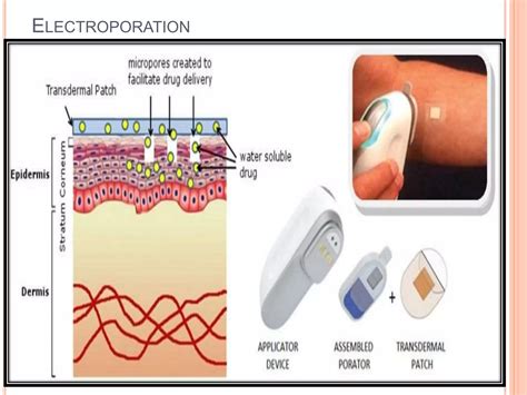 Unit Iii Transdermal Drug Delivery System Pptx