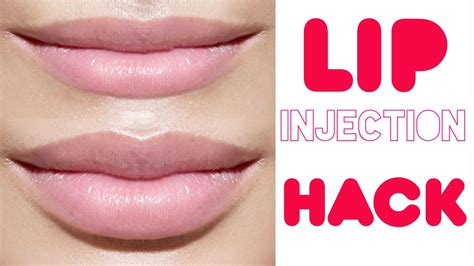 Lip Plumping No Injections At Gwen Staton Blog