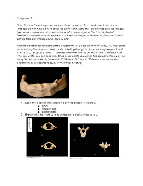 Anatomy Assignment 7 Labeling Bones And Vertebrae Structures Studocu