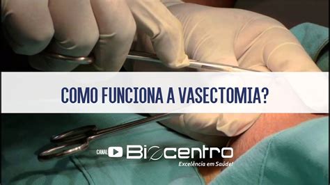 Como E Feita A Cirurgia De Vasectomia Zuledu