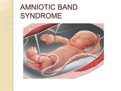 Aminoscopy And Fetoscopy Invasive Procedure Pptx