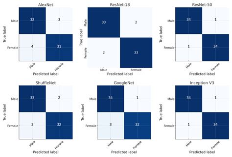 Deep Learning For Sex Estimation From Whole Foot X Rays Benchmarking