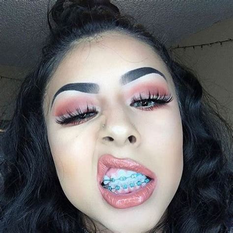 Braces Braces Makeup Makeup On Fleek Teeth Braces Cute Braces