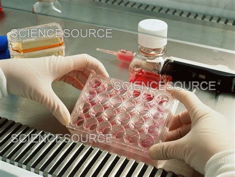 Hepatitus Virus Testing Stock Image Science Source Images