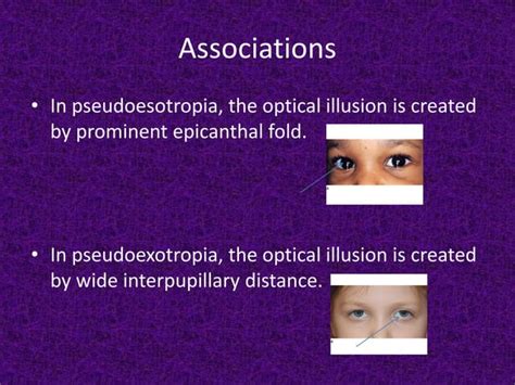 Diseases Of Ocular Motility Pdf