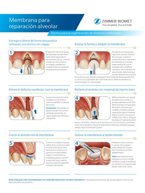 Zbinst0001es Rev A Socket Repair Membrane Tech Guide Final Secured Pdf Hueso