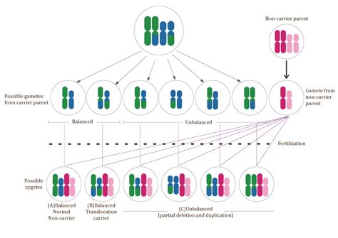 Robertsonian Translocation Balanced Vs Unbalanced