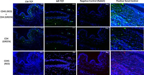 Cd45 Pan Leucocyte Marker And Cd4 T Cells On Immunofluorescence Show