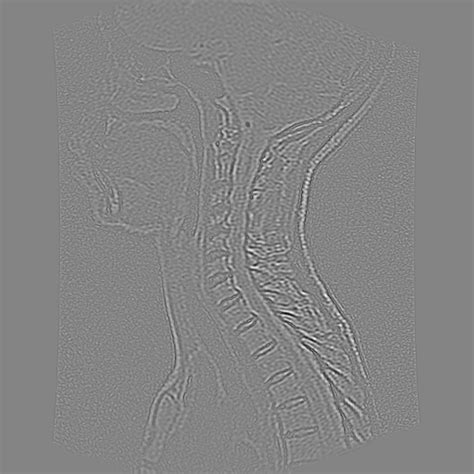 Image Segmentation Machine Learning Image Analysis Image Sc Forum