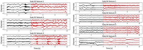 raw signal showing several seizures from subjects 2 and 4 of the