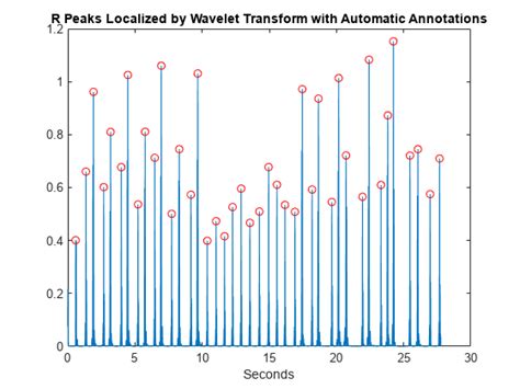Wavelet Analysis Of Physiologic Signals Matlab And Simulink Example