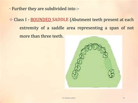 Classification Systems For Partially Edentulous Arches Pptx Dental