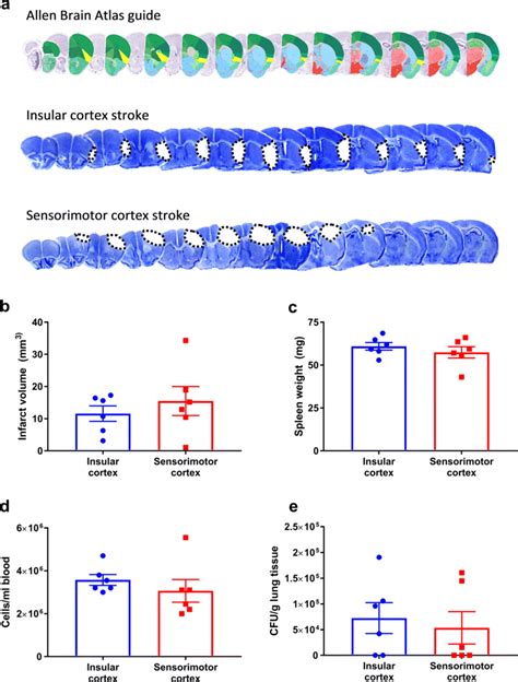 Infarct Localisation In The Insular Cortex Does Not Worsen Infection