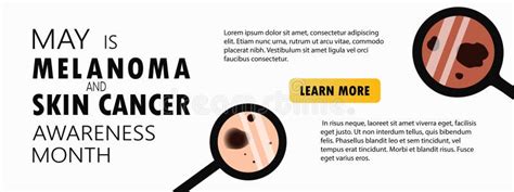 Melanoma And Skin Cancer Awareness Month Vector Illustration Stock