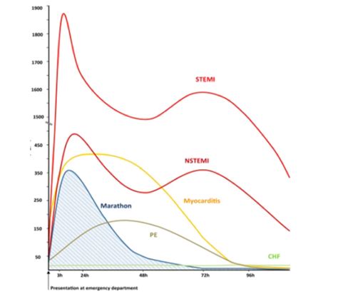 May 2023 Peripheral Brain