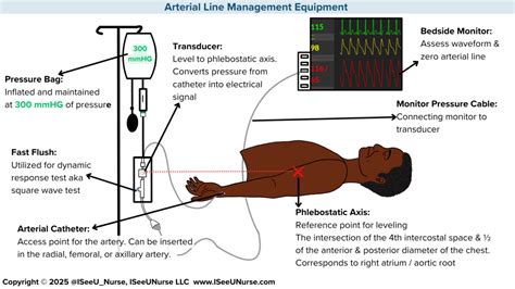 Arterial Line Basics For Critical Care Nurses Iseeunurse With Sarah