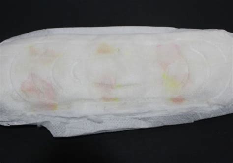 Vaginal Discharge Yeast Infection