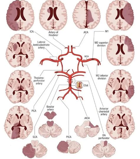 Neurology Neurology Added A New Photo