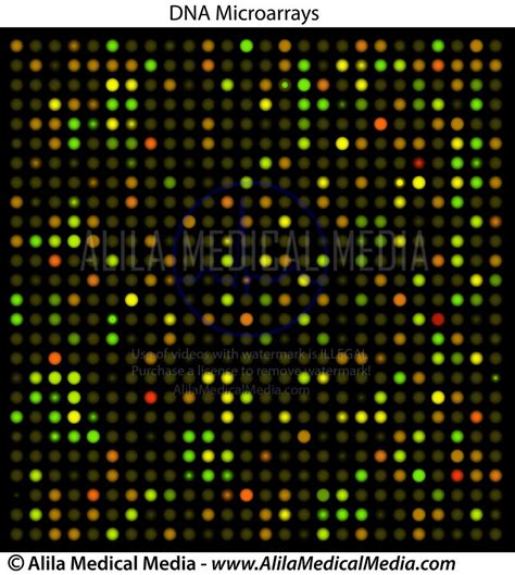 Alila Medical Media Dna Microarrays Used In Ex Cancer Research Medical Illustration