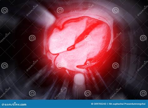 Cardiac Mri Images Are Instrumental In Assessing Cardiac Health
