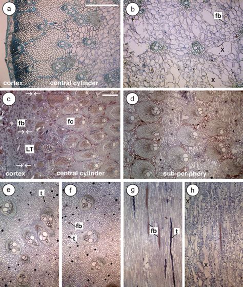 Bactris Spp Stem Anatomy In Early Development All Stained In Tannic