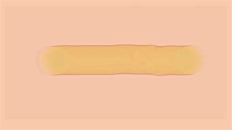 L P Ponor On Linkedin Arc