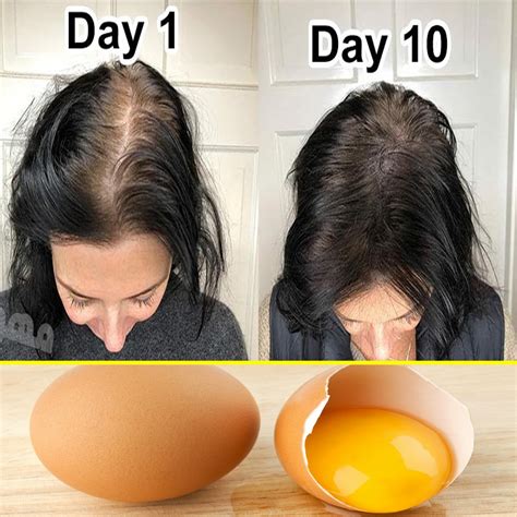How To Grow Long And Thick Hair With Egg Worlds Best Remedy For Hair Growth How To Grow