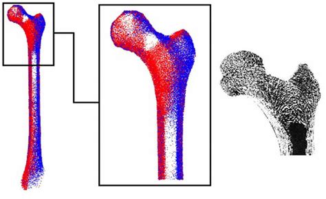 Orthotropic Finite Element Modelling Of The Skeletal System Research