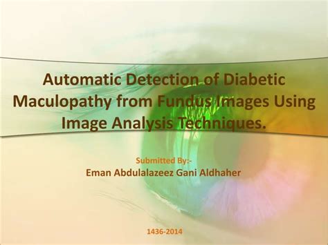 Automatic Detection Of Diabetic Maculopathy From Fundus Images Using