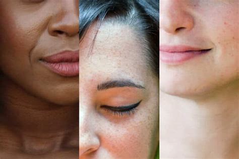 Does Skin Color Affect Body Temperature