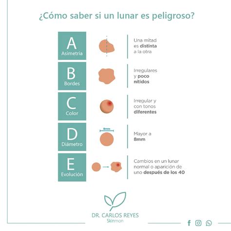 Conoce El Abcde De Los Lunares Dr Carlos Reyes Skinmon