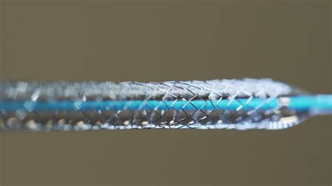 How Has Nanotechnology Helped The Development Of Nitinol