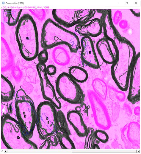 detection of myelin · issue 8 · montpellierressourcesimagerie imagej
