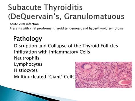 Ppt Subacute Thyroiditis And Related Disorders Powerpoint