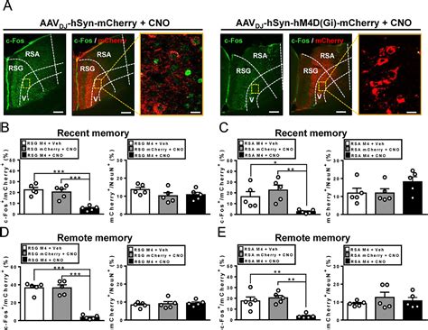 Distinct Contribution Of Granular And Agranular Subdivisions Of The Retrosplenial Cortex To
