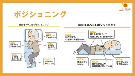 褥瘡がある利用者のアセスメントポイントと気を付けることは？【訪問看護】 訪問看護・リハビリのメディセプト・いきいきsun