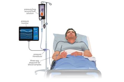 Hemodynamic Monitoring Nursing Information Icu Nursing Nursing Students