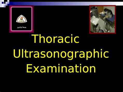 Ppt Thoracic Us Dokumentips