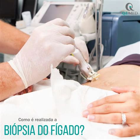 Procedimento De Biopsia Hepatica Técnica De Biópsia Hepática Guiada