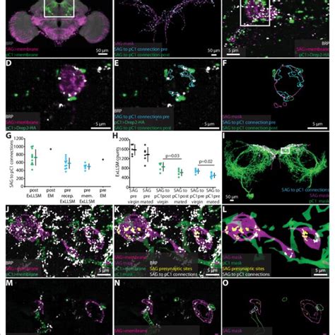 Features Of Traditional Light Microscopy Electron Microscopy And Download Scientific Diagram