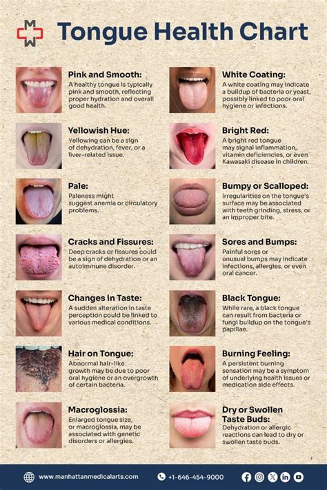 What Is The Healthy Color Of Tongue