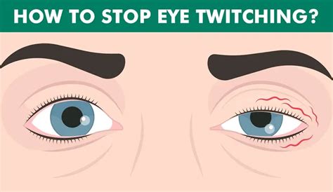 Eye Twitching Blepharospasm Ophthalmology Clinic Drhc Dubai
