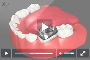 Dental Patient Educational Videos Oral Surgery Dc