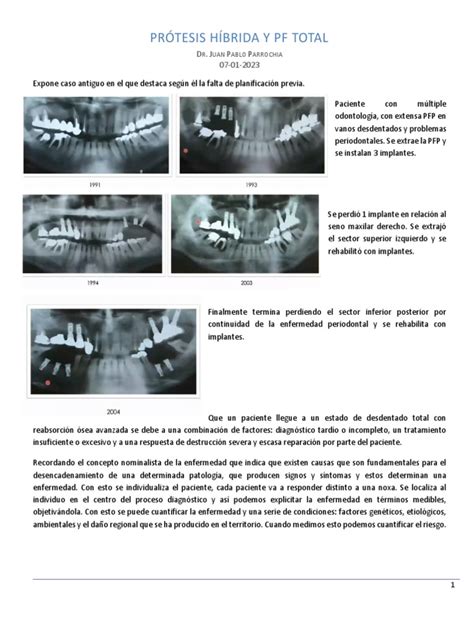 Protesis Hibrida Y Pf Total Pdf Dentadura Postiza Implante Dental