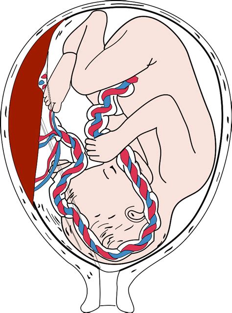 Download Placenta Svg Freepngimg